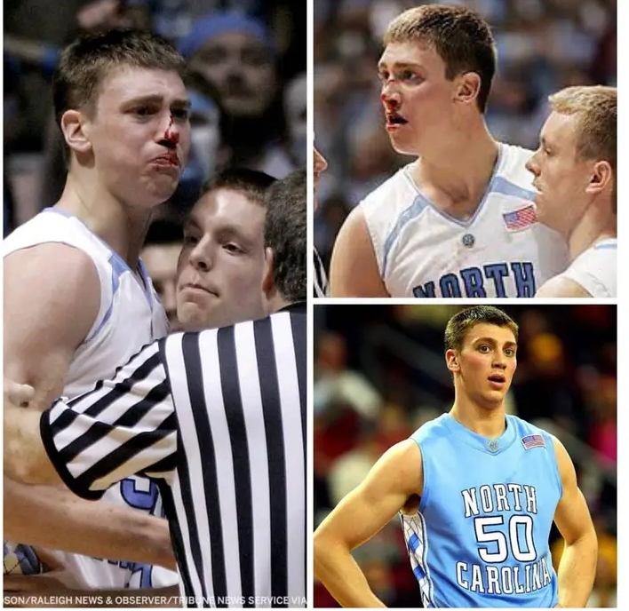 SAD Report — ESPN Said 16 YEARS AGO: Tyler Hansbrough’s Bloodied ...